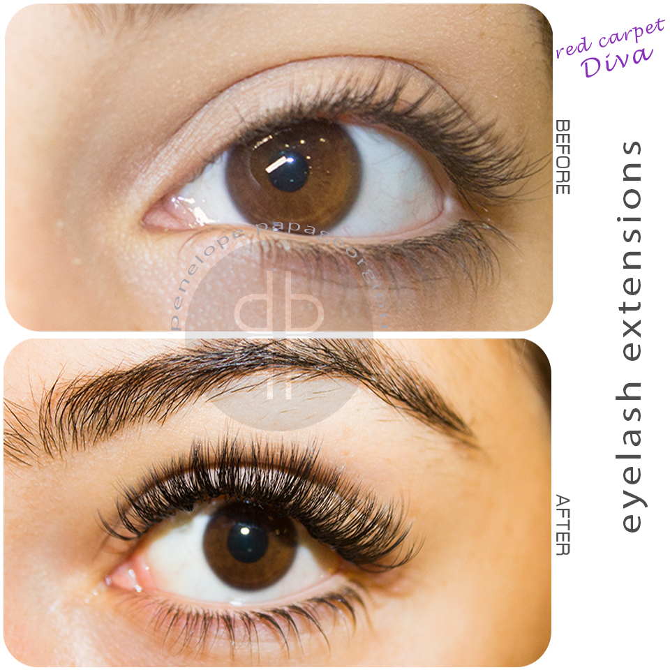 eyelash-extensions-12 - P-Prosopo